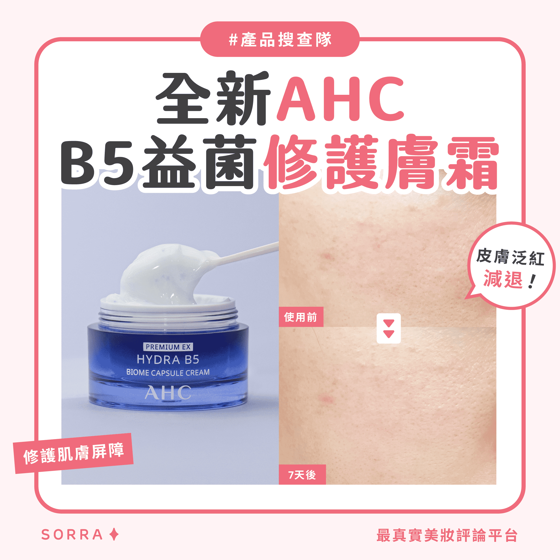 【#sorra產品搜查隊】全新AHC B5 益菌修護膚霜 - SORRA