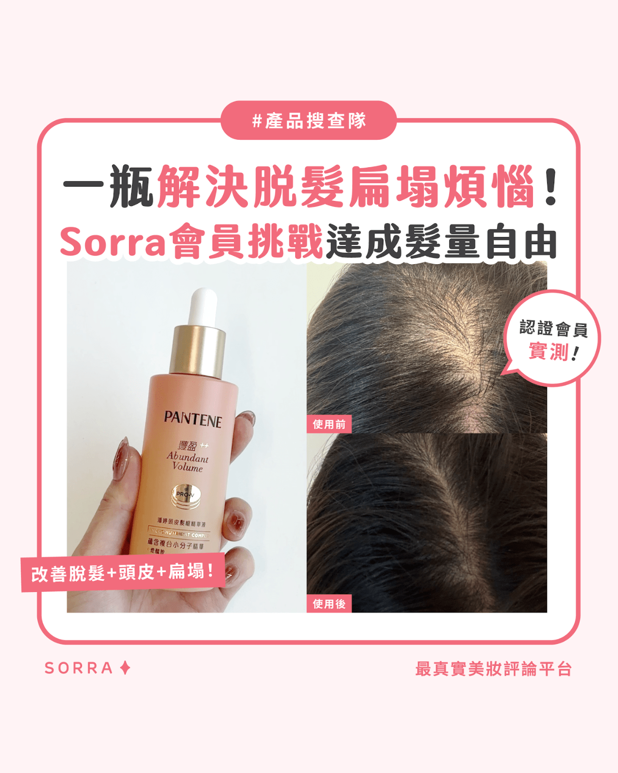 【#sorra產品搜查隊】一瓶解決脫髮扁塌煩惱！達成髮量自由！ - SORRA